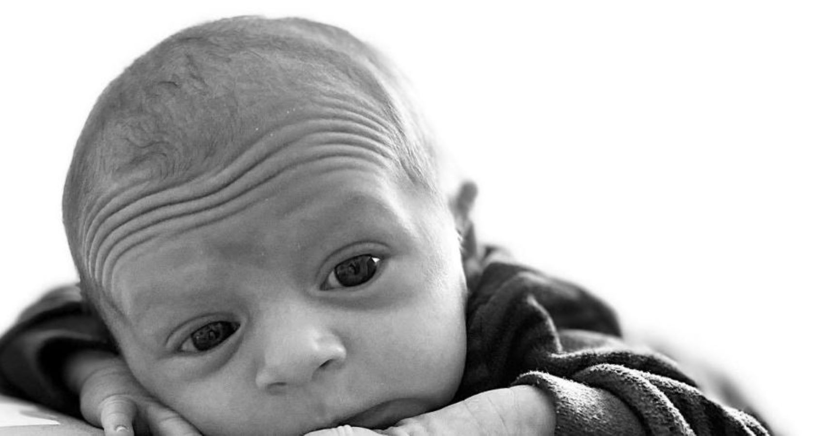 Baby Born During Pandemic Without Immune System Undergoes Bone Marrow ...